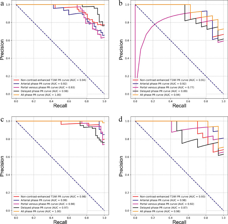Multi-phase contrast-enhanced magnetic resonance image-based radiomics-combined machine learning ...