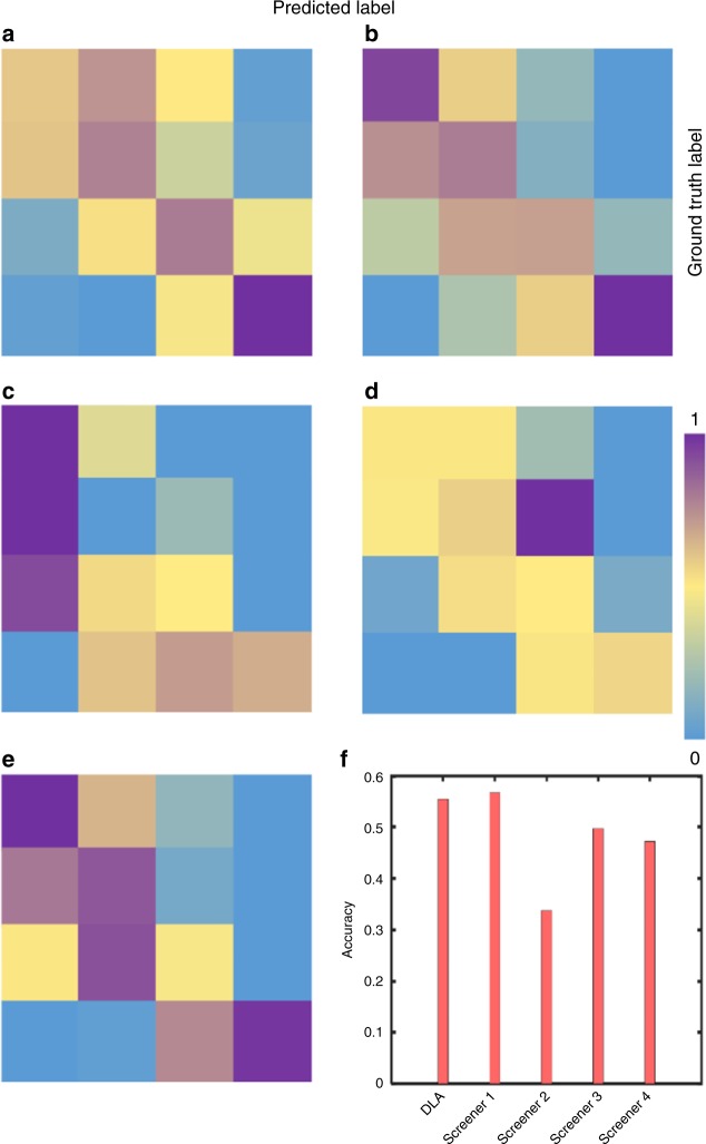 Development and validation of deep learning algorithms for scoliosis screening using back images ...