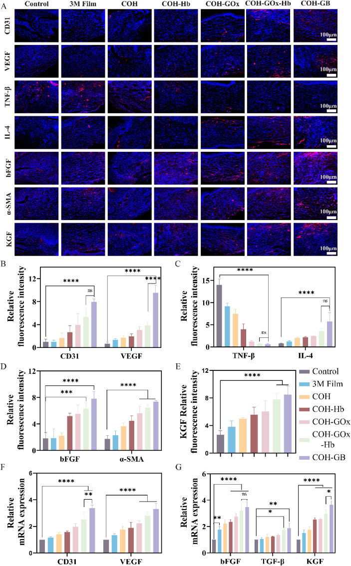 Artificial multienzyme nanoflower composite hydrogel for efficiently promoting MRSA-infected ...