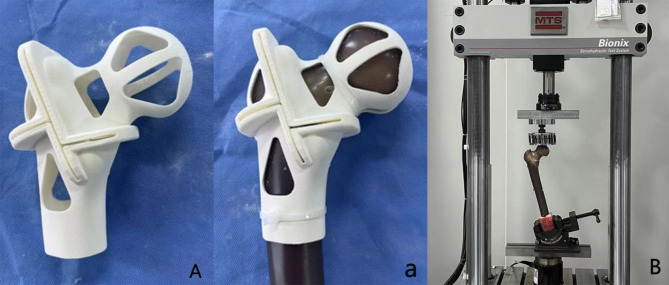 The proximal femoral universal nail system (PFUN): a novel intramedullary nail for treating ...