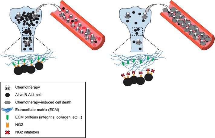 NG2 antigen is a therapeutic target for MLL-rearranged B-cell acute ...