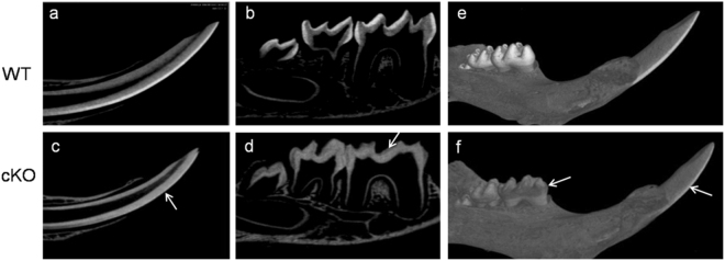 Ablation of Runx2 in Ameloblasts Suppresses Enamel Maturation in Tooth Development - PMC
