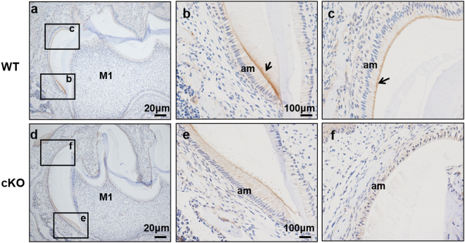 Ablation of Runx2 in Ameloblasts Suppresses Enamel Maturation in Tooth Development - PMC