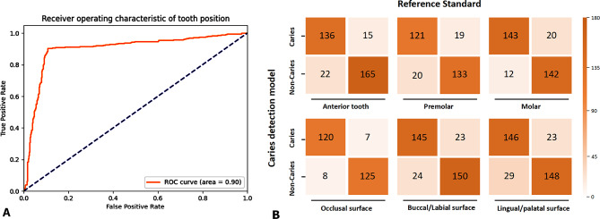 Caries lesions diagnosis with deep convolutional neural network in intraoral QLF images by ...