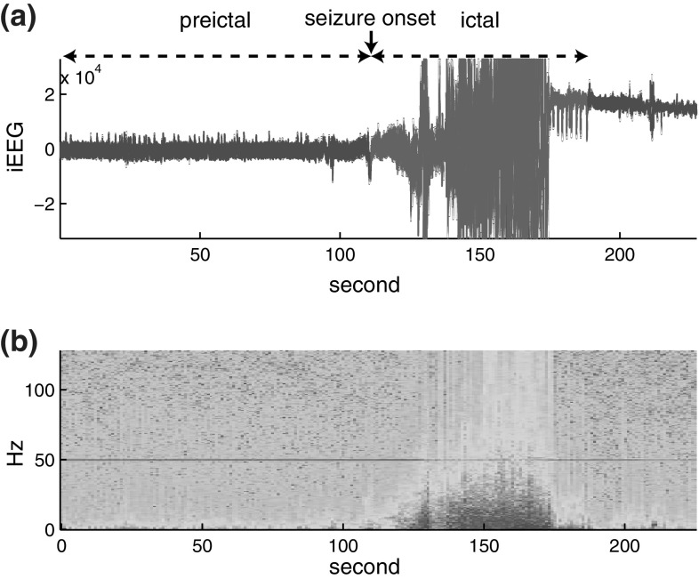 On predicting epileptic seizures from intracranial electroencephalography - PMC