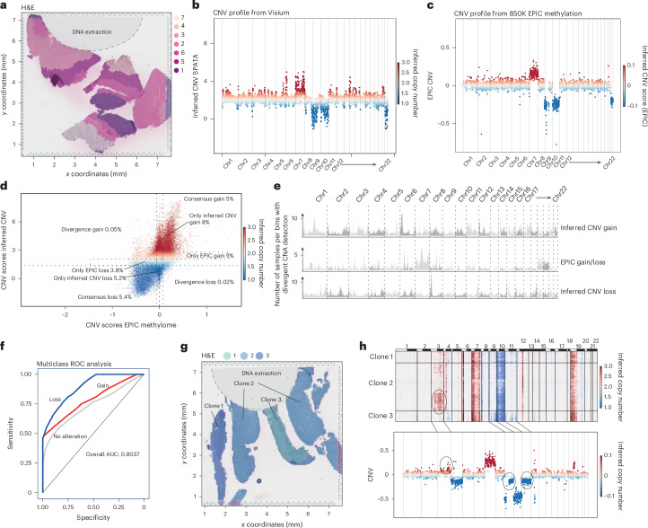 Spatially resolved transcriptomics and graph-based deep learning improve accuracy of routine CNS ...
