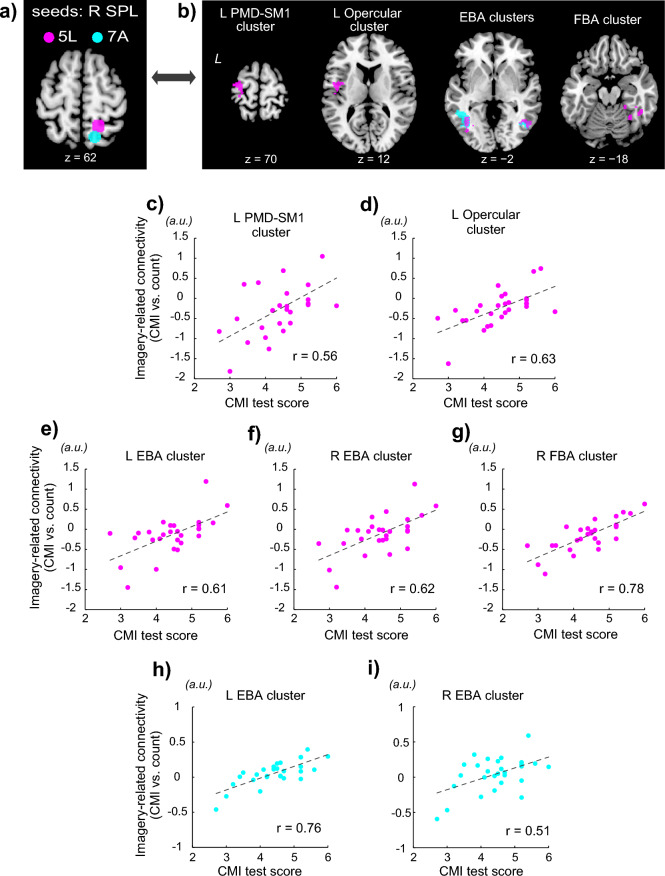 Structural and functional features characterizing the brains of individuals with higher ...