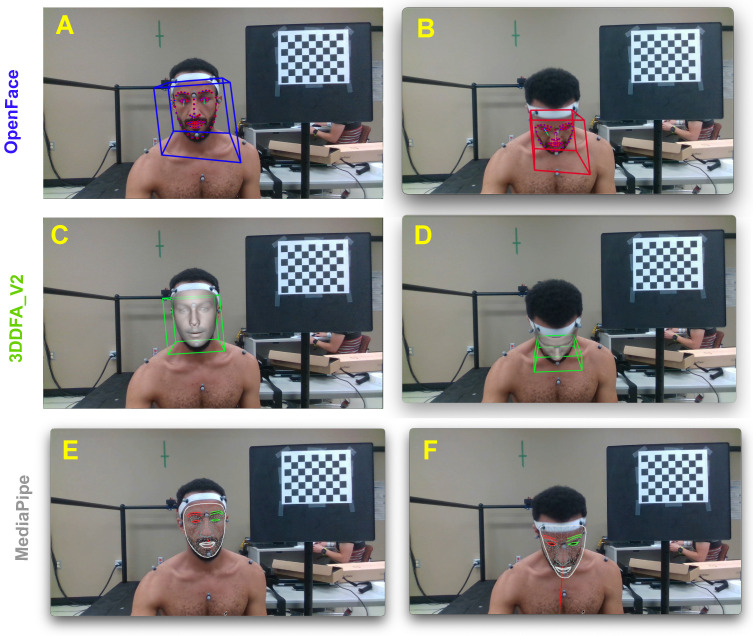Evaluation of Various State of the Art Head Pose Estimation Algorithms for Clinical Scenarios - PMC