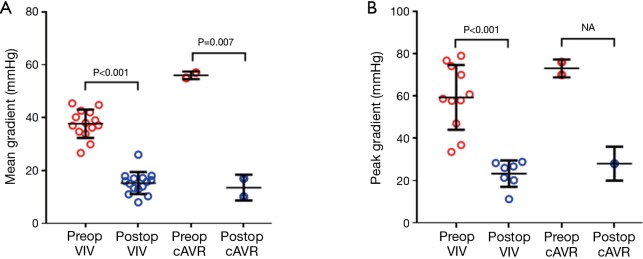 Transcatheter valve-in-valve implantation versus reoperative conventional aortic valve ...