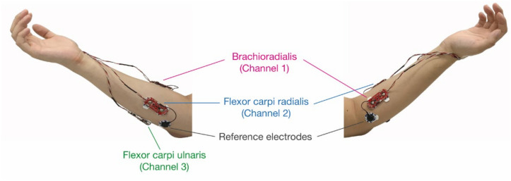 Electromyogram-Based Classification of Hand and Finger Gestures Using Artificial Neural Networks ...