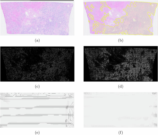 Integrative whole slide image and spatial transcriptomics analysis with QuST and QuPath - PMC