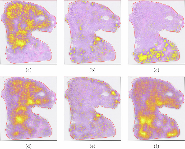 Integrative whole slide image and spatial transcriptomics analysis with QuST and QuPath - PMC