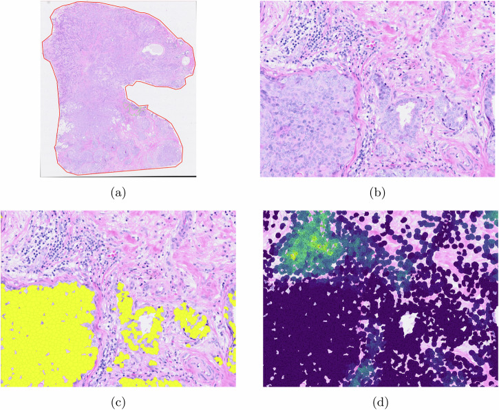 Integrative whole slide image and spatial transcriptomics analysis with QuST and QuPath - PMC