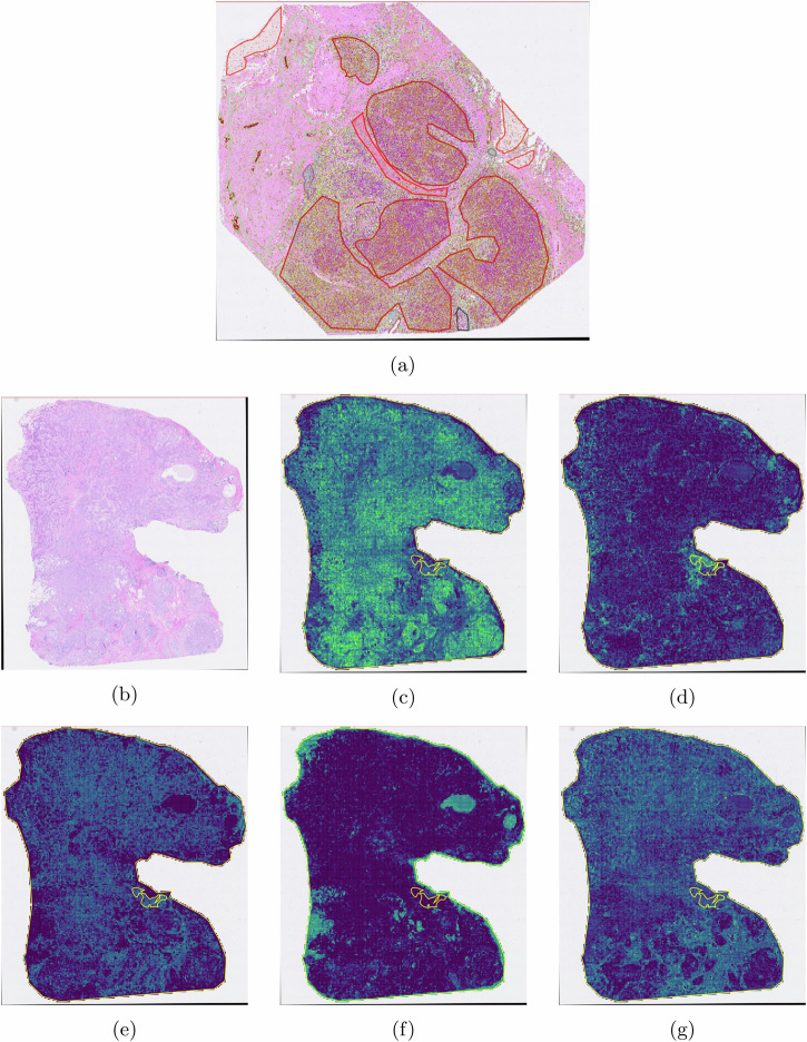 Integrative whole slide image and spatial transcriptomics analysis with QuST and QuPath - PMC