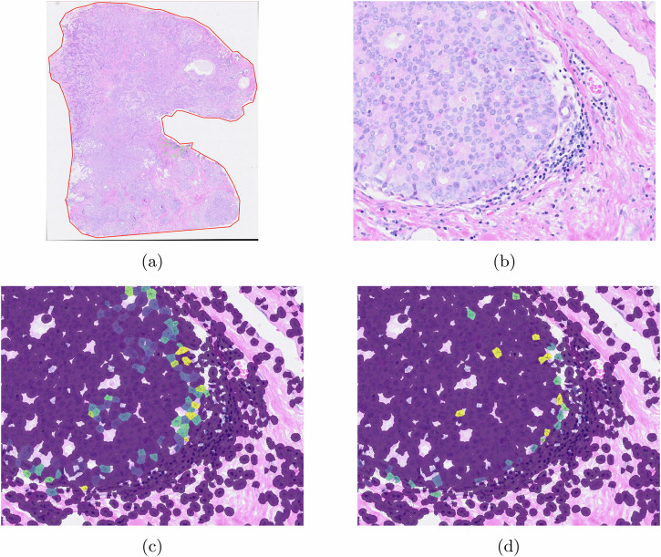 Integrative whole slide image and spatial transcriptomics analysis with QuST and QuPath - PMC