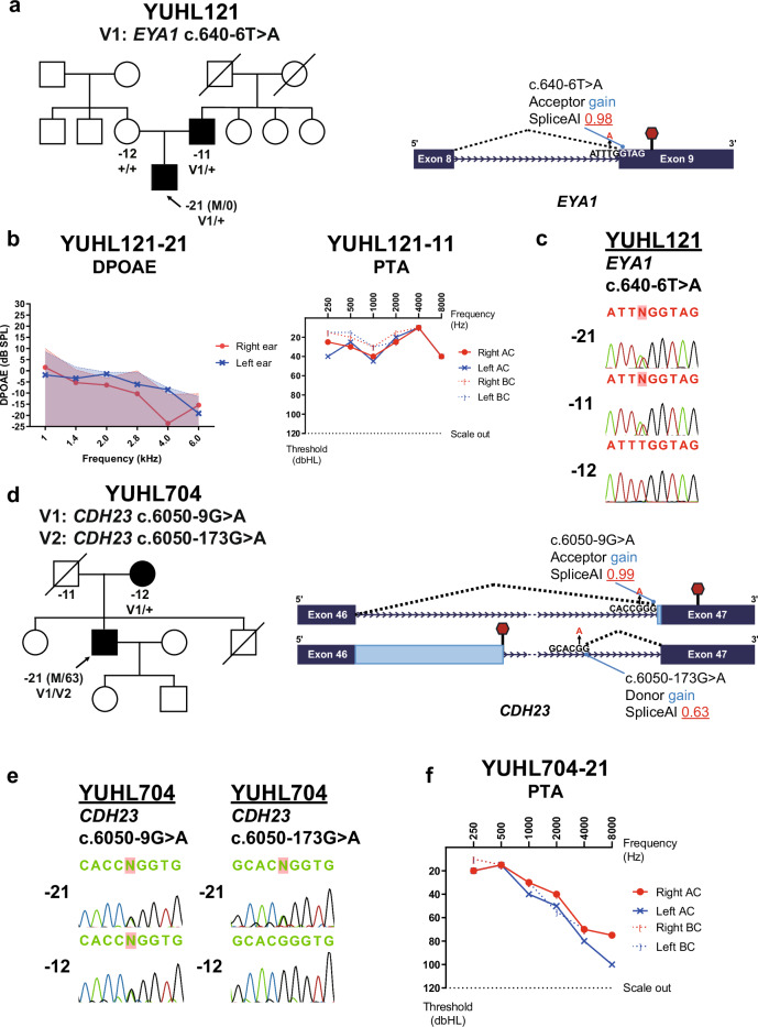 Systematic genetic assessment of hearing loss using whole-genome sequencing identifies ...