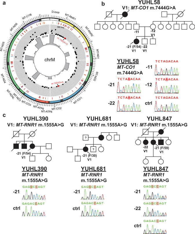 Systematic genetic assessment of hearing loss using whole-genome sequencing identifies ...