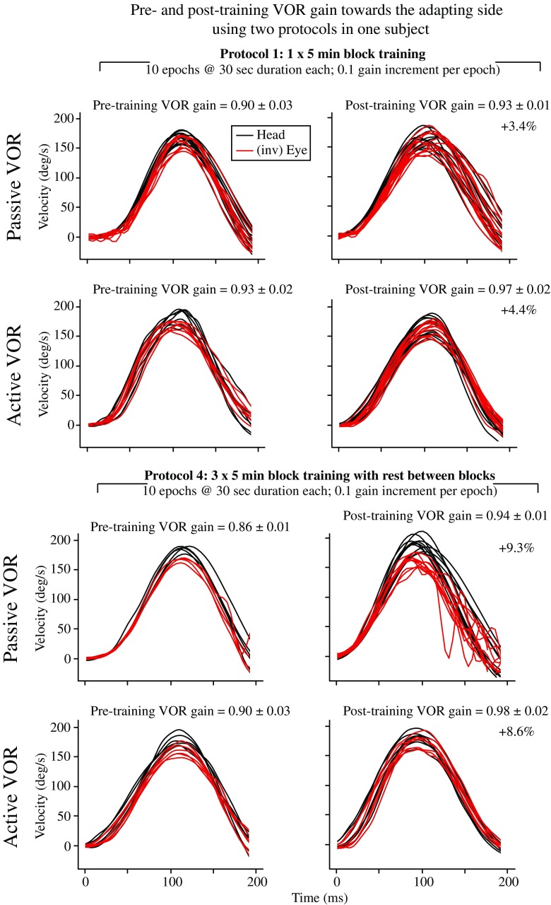 Human Vestibulo-Ocular Reflex Adaptation: Consolidation Time Between Repeated Training Blocks ...