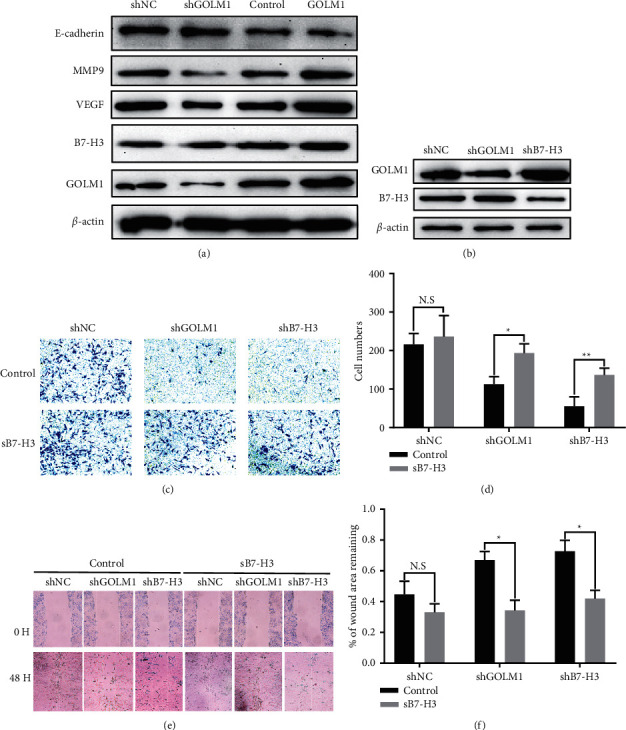 GOLM1 as a Potential Therapeutic Target Modulates B7-H3 Secretion to ...