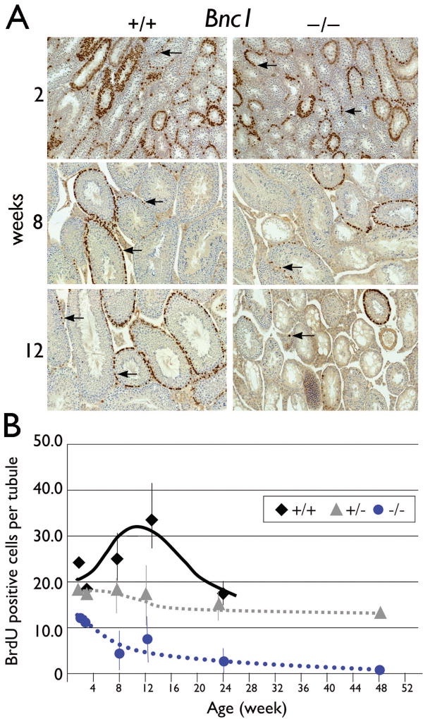 BNC1 is required for maintaining mouse spermatogenesis - PMC