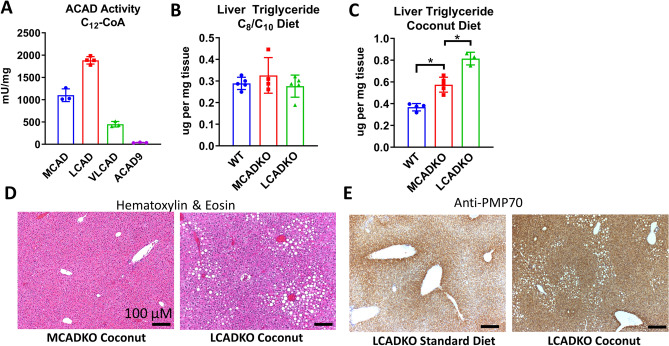 Impaired mitochondrial medium-chain fatty acid oxidation drives periportal macrovesicular ...