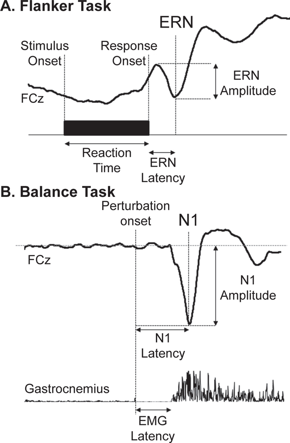 Do sensorimotor perturbations to standing balance elicit an error-related negativity? - PMC