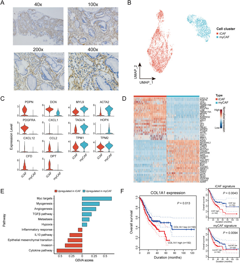 Comparative single-cell analysis reveals heterogeneous immune ...