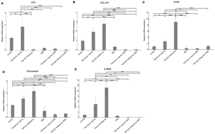 Fibrotic Response Of Human Trabecular Meshwork Cells To Transforming