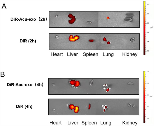 Electroacupuncture-driven endogenous circulating serum exosomes as a ...