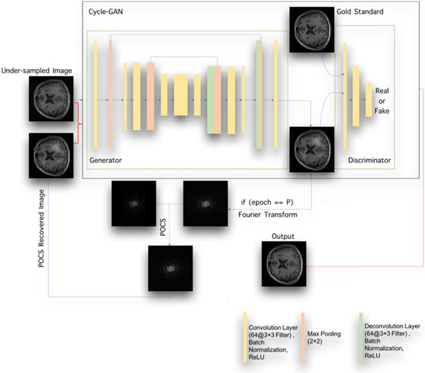 POCS-Augmented CycleGAN for MR Image Reconstruction - PMC