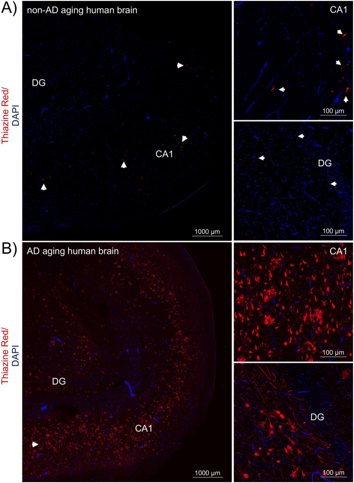 Detection, visualization and quantification of protein complexes in ...