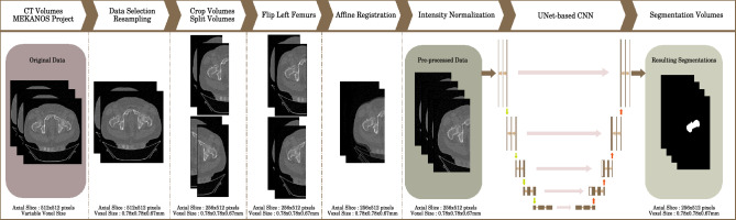 Finite element models with automatic computed tomography bone segmentation for failure load ...