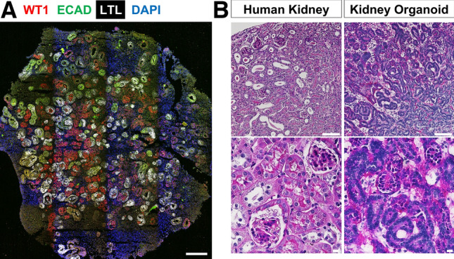 Single-cell RNA sequencing and kidney organoid differentiation - PMC