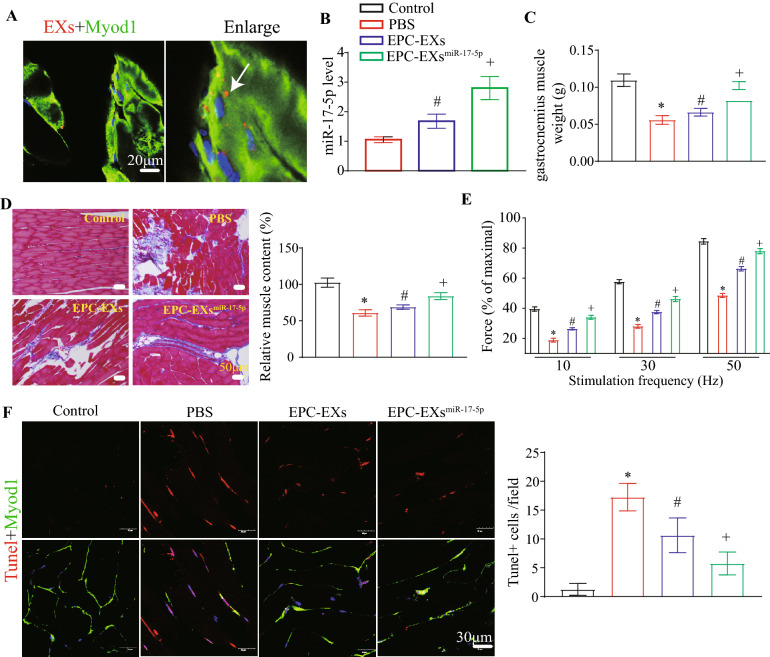 Enrichment of miR-17-5p enhances the protective effects of EPC-EXs on vascular and skeletal ...