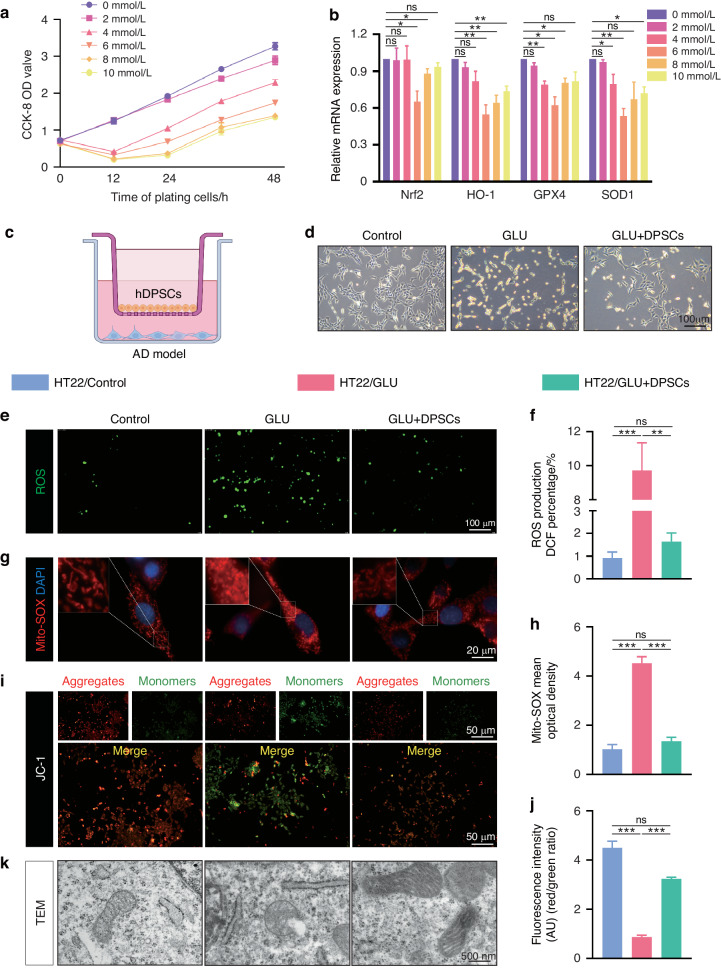 Human dental pulp stem cells mitigate the neuropathology and cognitive ...