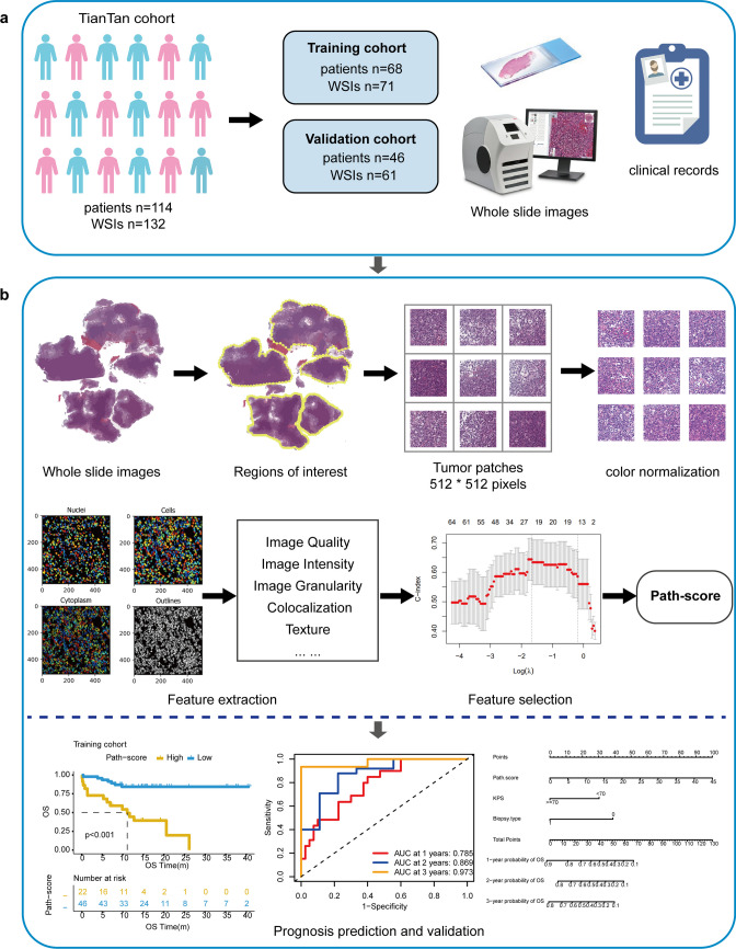 Machine learning-based pathomics signature of histology slides as a novel prognostic indicator ...