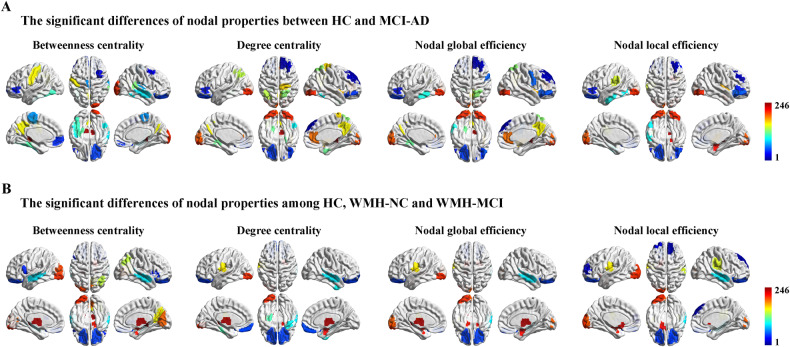 The characteristic patterns of individual brain susceptibility networks underlie Alzheimer’s ...