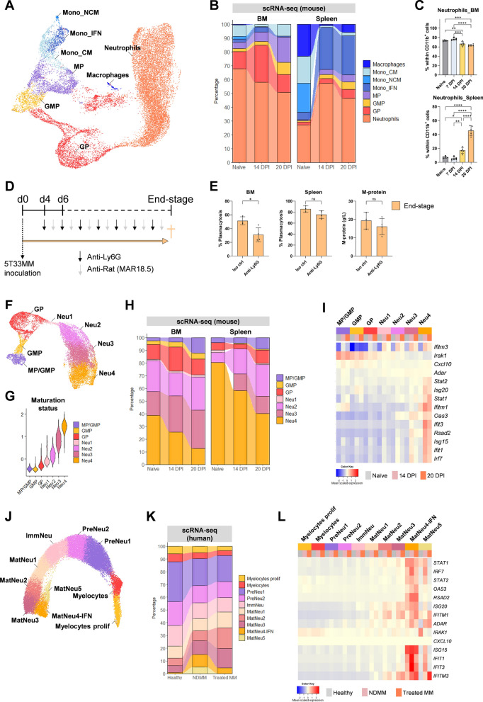 A single-cell transcriptomic map of the murine and human multiple myeloma immune ...