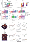 Spatial Isoforms Reveal the Mechanisms of Metastasis - PubMed