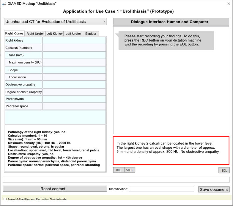 Efficient structured reporting in radiology using an intelligent dialogue system based on speech ...