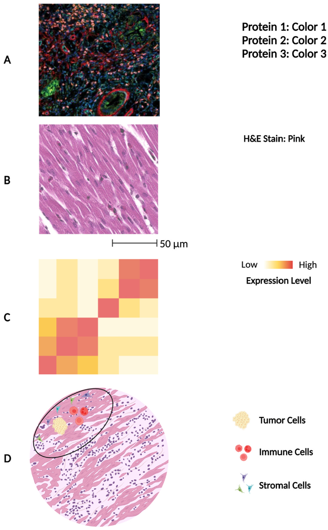Deep learning-based multimodal spatial transcriptomics analysis for cancer - PMC