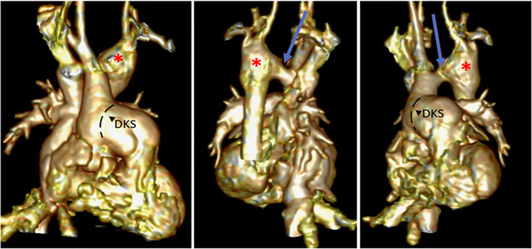 Performance Of Cardiac Mri In Pediatric And Adult Patients With Fontan