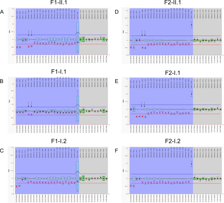 Optimized MLPA workflow for spinal muscular atrophy diagnosis: identification of a novel variant ...