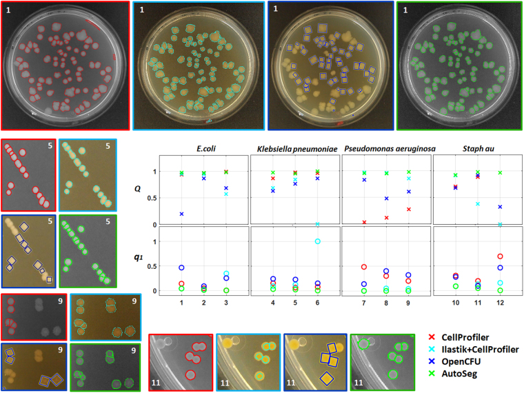 AutoCellSeg: robust automatic colony forming unit (CFU)/cell analysis using adaptive image ...
