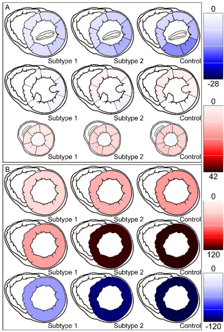 Complementary classification of hypertrophic cardiomyopathy using unsupervised cluster analysis ...
