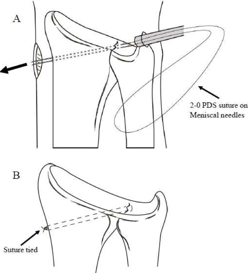Chronological and geographic trends of TFCC Repair - PMC