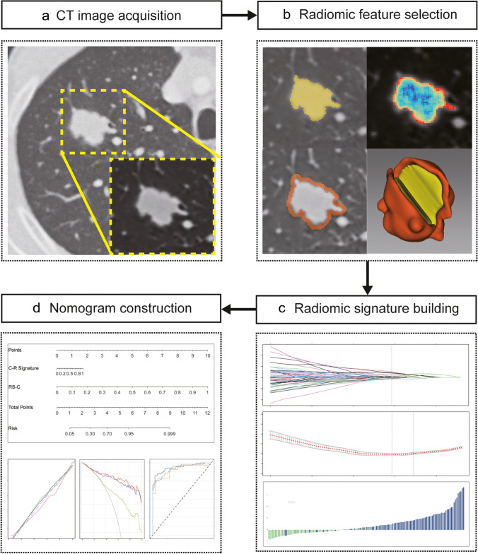 Development and validation of a preoperative CT-based radiomic nomogram to predict pathology ...