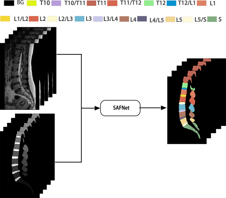 A spine segmentation method based on scene aware fusion network - PMC